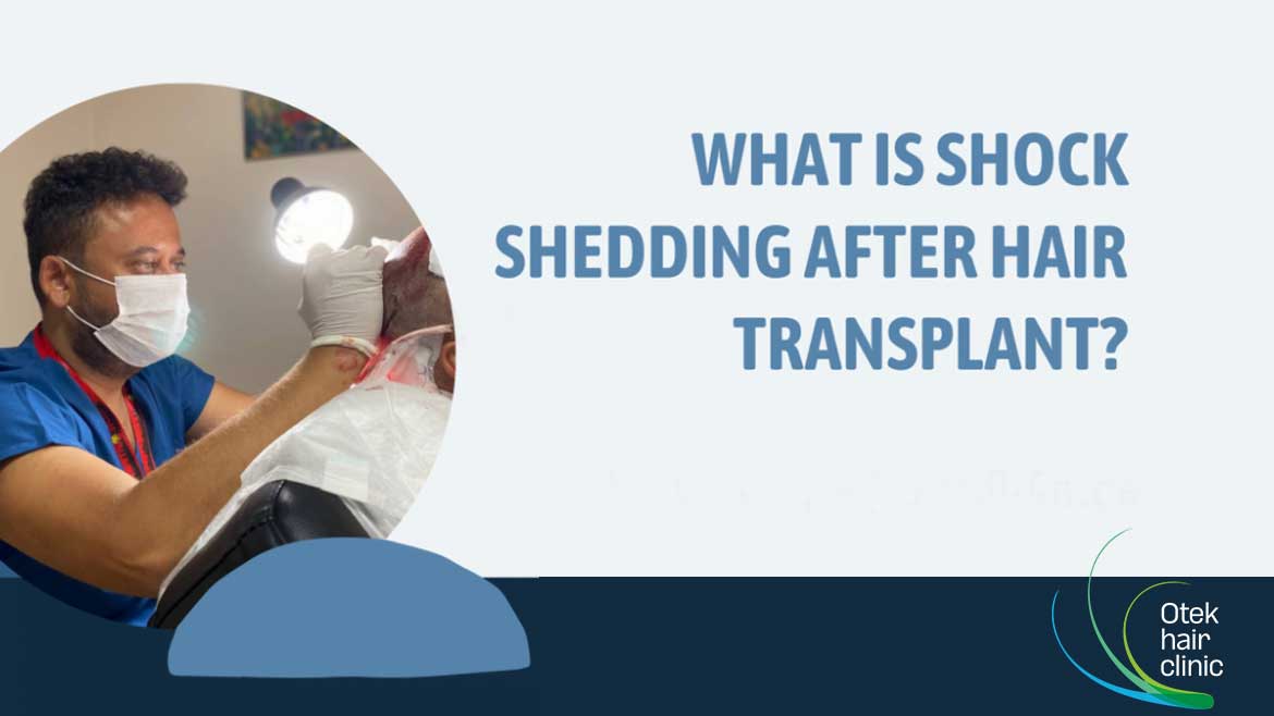 What is Shock Shedding After Hair Transplant? - Hair Transplant Antalya ...